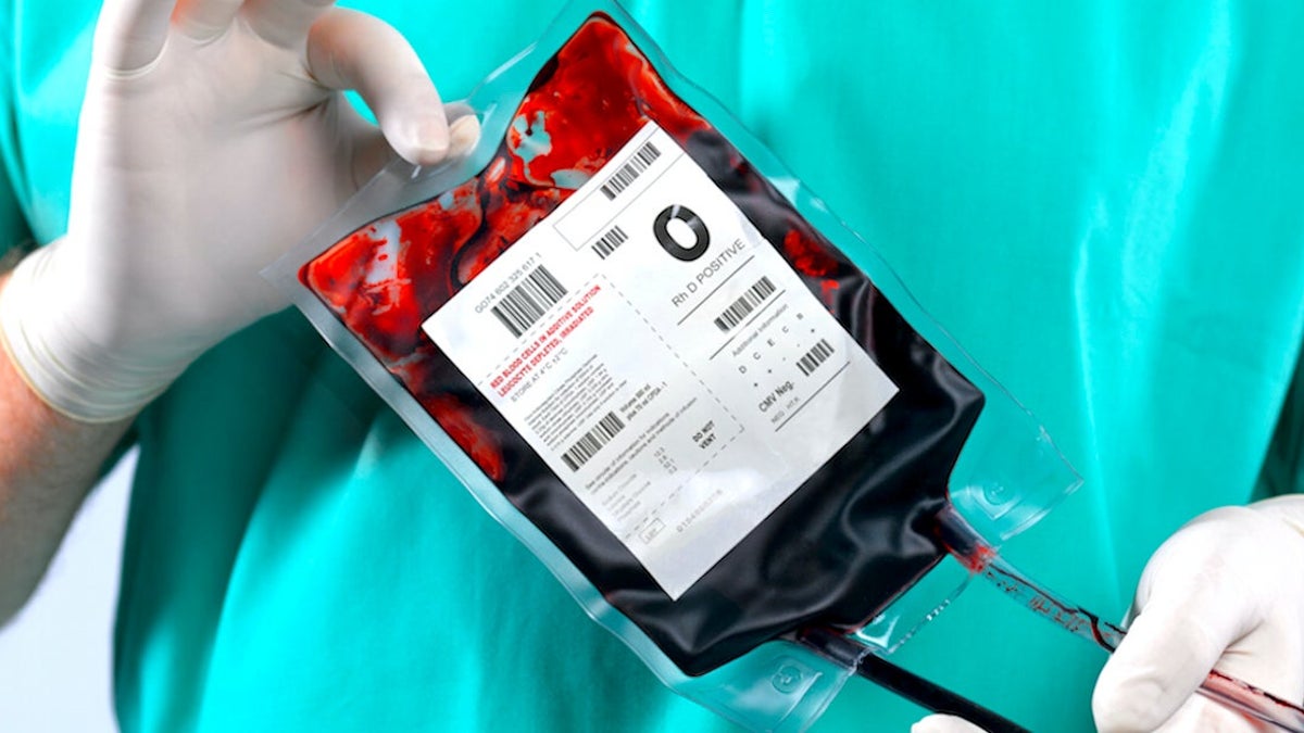 Ask Pete: How Does Blood Donation Affect Running?