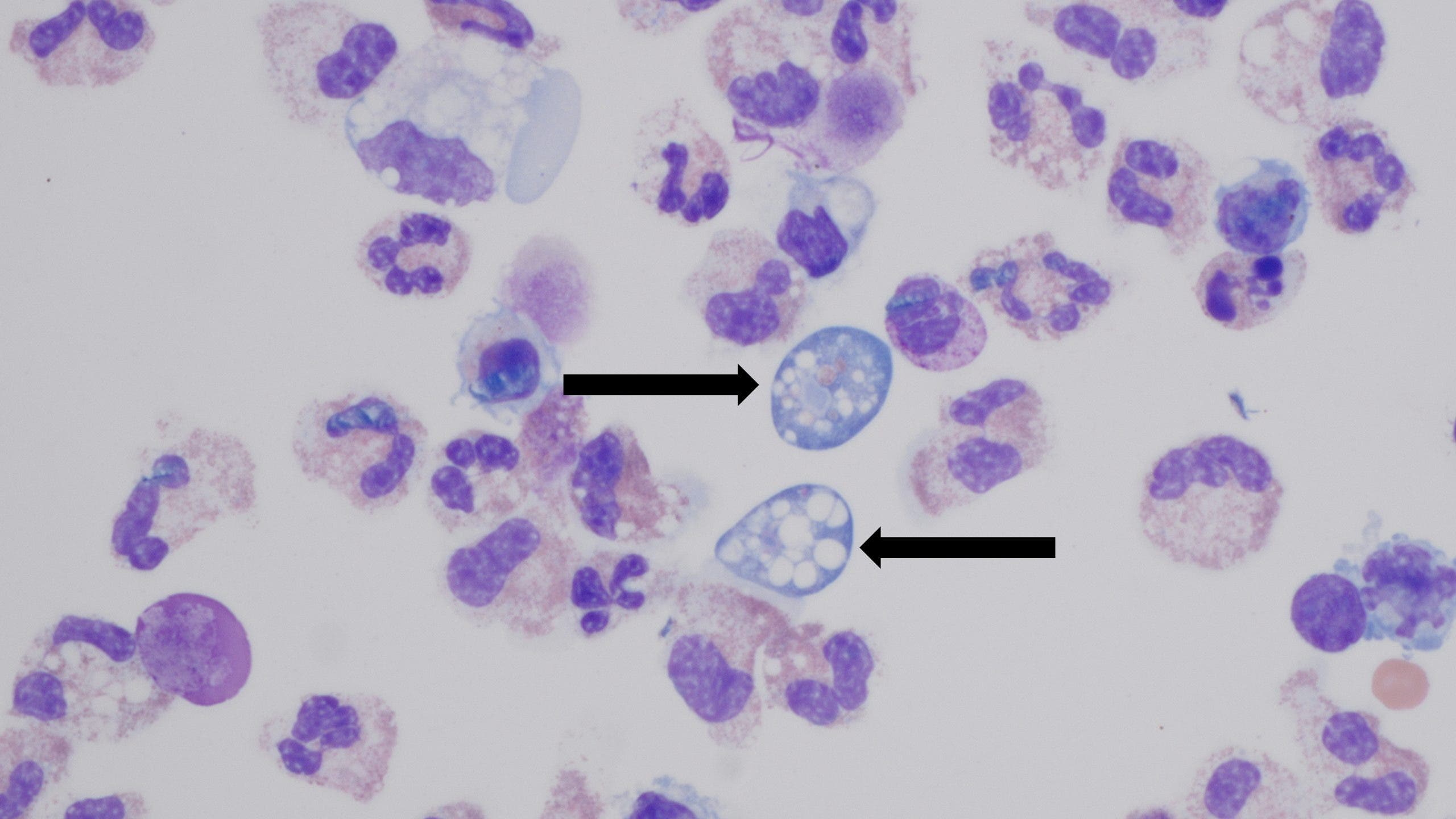 Brain-Eating Amoeba Found in Several National Park Hot Springs