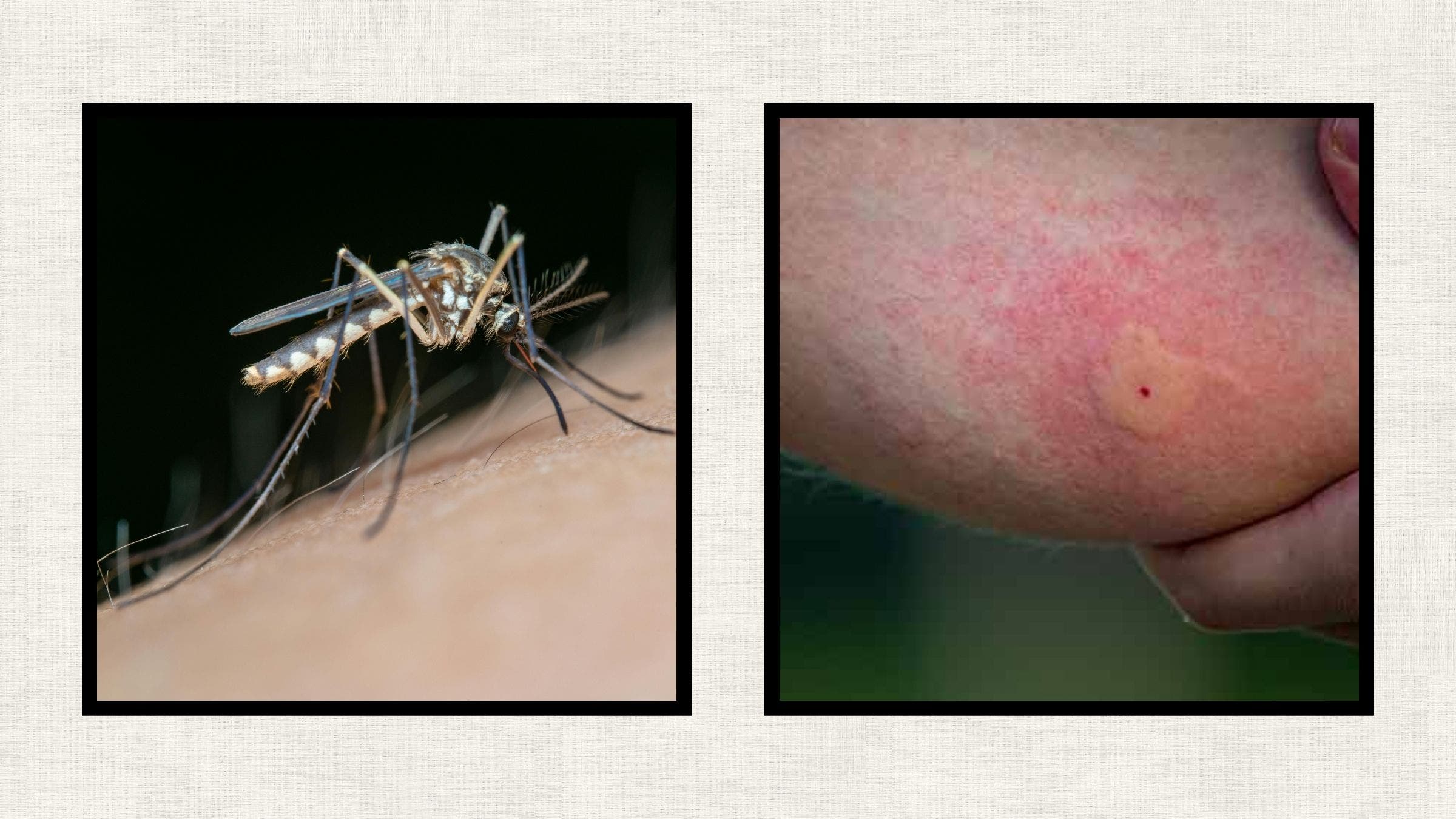10 Most Common Bug Bites and Rashes, with Photos